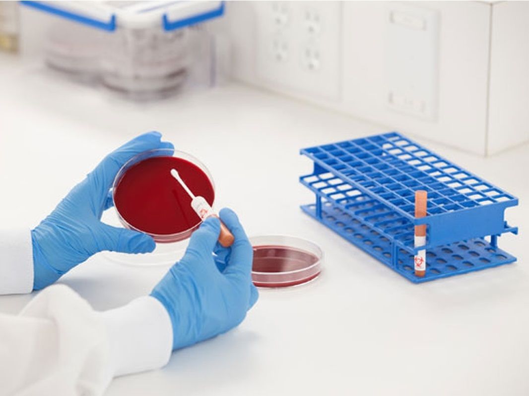 KWIK-STIK™ Plus | כמיטק - פתרונות רפואיים מתקדמים